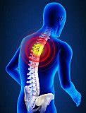 Osteoporotic Compression Fractures We Treat These Conditions