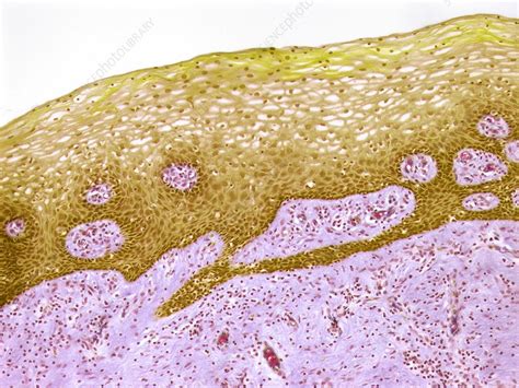 Human Cervix Light Micrograph Stock Image C0238243 Science