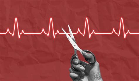 Editorial Simplify Norms For Euthanasia Telangana Today