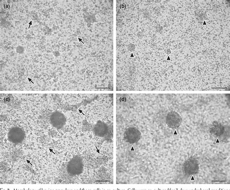 Figure 2 From Interaction Of Bovine Granulosa And Theca Cells In A