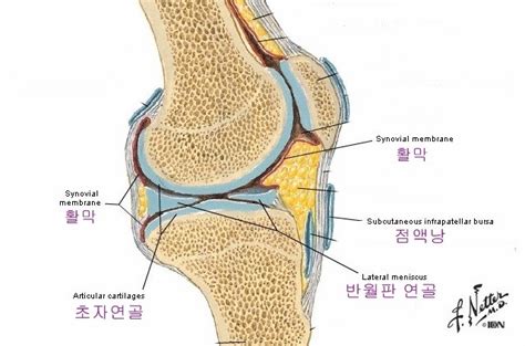무릎이 아파요 퇴행성 무릎 관절염 원인과 치료 바른맥한의원 네이버 블로그