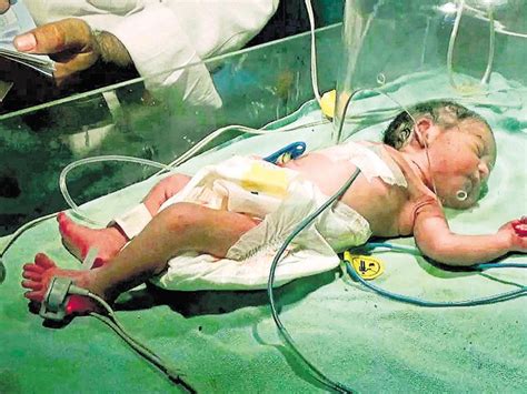 Sex Ratio Improves In Delhi But Infant Mortality Up Latest News Delhi Hindustan Times