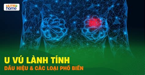 B Nh V V Th Ng G P D U Hi U Nh N Bi T V Nguy N Nh N