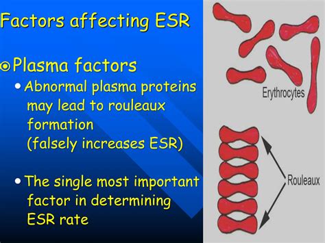 Methods Used For Testing Sickling Test Ppt