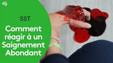 Comment réagir à un saignement abondant Formation SST YouTube