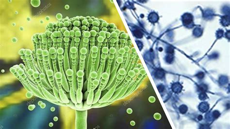 Fungal Pneumonia 11 Pptx