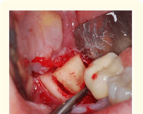 Image Showing Roots Extraction Download Scientific Diagram