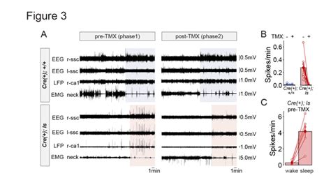 Rectification Of State Dependent Paroxysmal Spiking Events In Syngap1