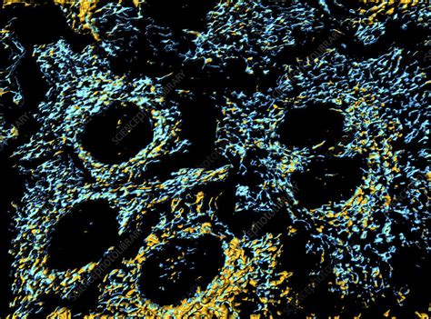 Hela Cells Light Micrograph Stock Image C0286923 Science Photo
