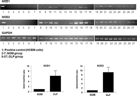 Gene Expression Analysis Of Nucleotide Binding Oligomerization Domain