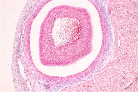 Testicules Ovaires Histologiques Et Cellules Humaines De Spermatozoïdes