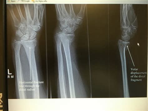 Named Fx Flashcards Quizlet