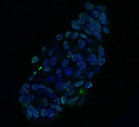 Head And Neck Cancer Organoids As A Step Towards Personalized Treatments