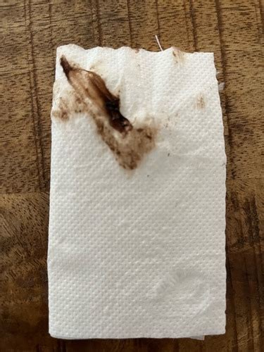 Foto 7 Weken Bruine Afscheiding En Traag Kloppend Hartje