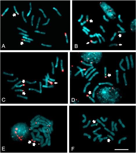 Fish With 45s Red And 5s Green Rdna Probes Against Metaphase