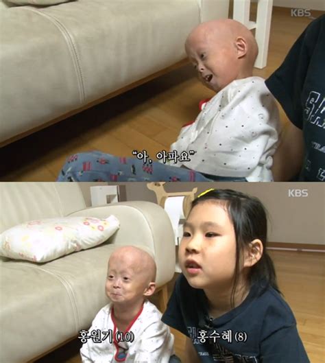 우리나라 단 1명 소아 조로증 앓는 아이 원기 하단 이미지를 누른 뒤 사연을 페이스북으로 공유하면 공유 한 건에