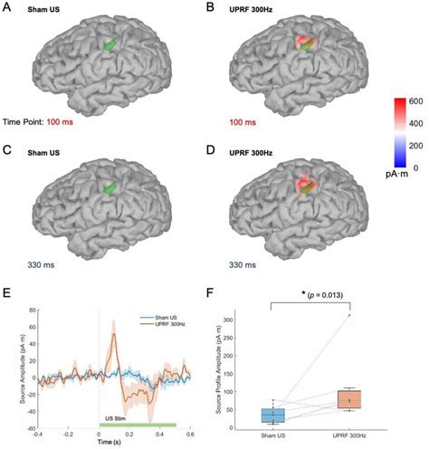 Eeg Spatiotemporal Responses At The Source Domain A D The Esi Download Scientific Diagram