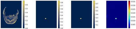 Brain Extraction Results For A Single Subject Left To Right Input