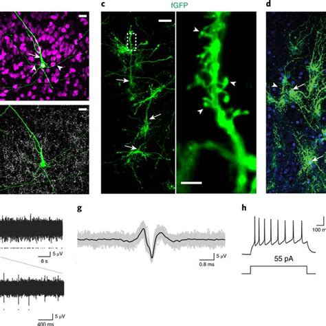 Culture At The Airliquid Interface Maintains Survival And Morphology
