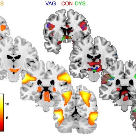 Central Processing Of Penile Vaginal Penetration Images PEN Central Download Scientific