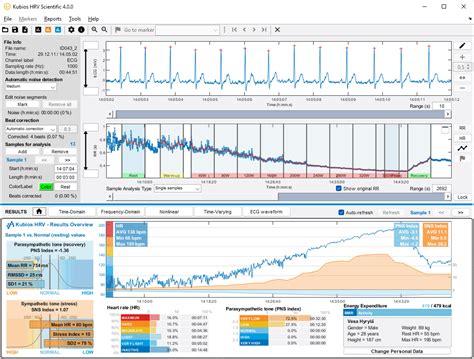 Kubios Hrv Scientific Kubios
