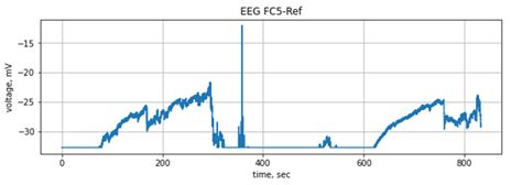 Flatline Detection Using Maxmin 💬 Support And Discussions Mne Forum