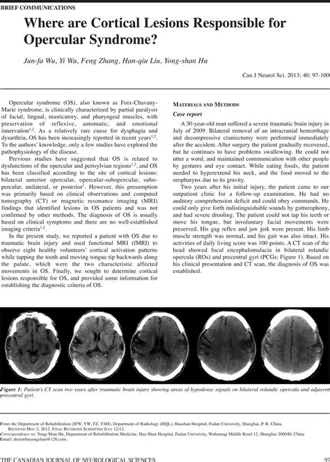 Where Are Cortical Lesions Responsible For Opercular Syndrome