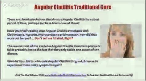 Mild Angular Cheilitis Angular Cheilitis Cure Youtube