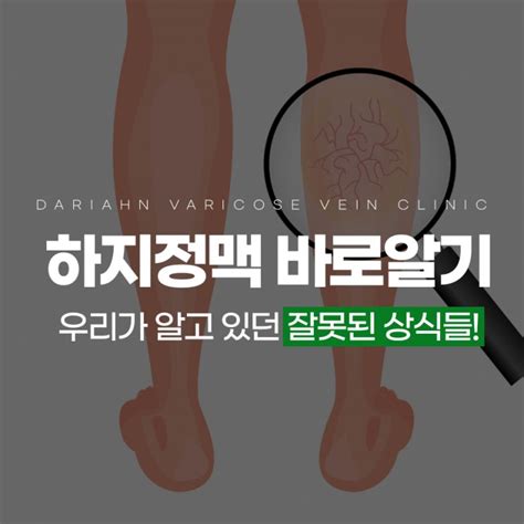 부산하지정맥류 잘못 알려진 상식들에 대해 알아볼까요 네이버 블로그