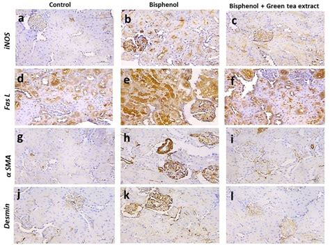 Representative Immunostaining Of Rats Renal Cortex Of The Different Representative Immunostaining Of Rats Renal Cortex Of The Different