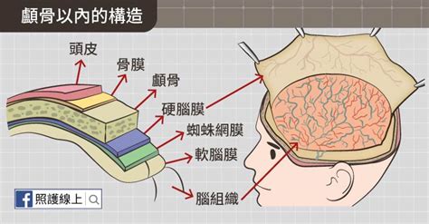 顱內出血有四種，每一種都很要命（懶人包）｜照護線上 媽咪拜mamibuy