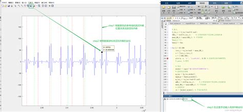 无接触母胎心电信号r峰打标代码（matlab） 胎心监测峰值matlab csdn博客