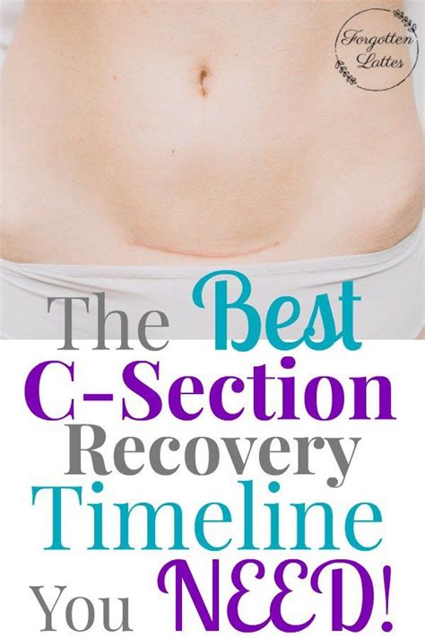 C Section Recovery Timeline A Week By Week Look At Recovery Artofit