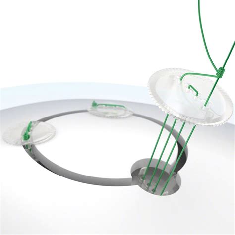 Cranial Fixation Gima Bambot Healthcare Ltd