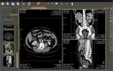 Images Of DICOM JapaneseClass Jp