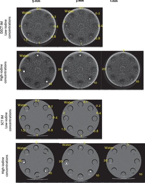 Dual‐energy Computed Tomography Dect And Subtraction Computed