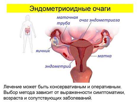 Новообразования женских половых органов презентация онлайн
