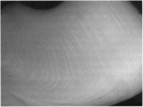 1 Polished Shell Cut Umbo Of The Marine Bivalve Arctica Islandica