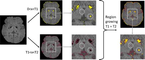Segmentation Of The Exemplary Image Using MiMSeg Based Adaptive