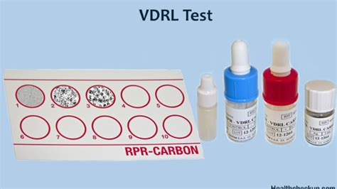 آزمایش Vdrl چیست؟ اصول، مراحل و تفسیر نتایج درگاه علوم پزشکی ایران مدلاین