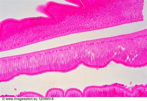 Simple Columnar Epithelium Ascaris Intestine Optical Microscope X200