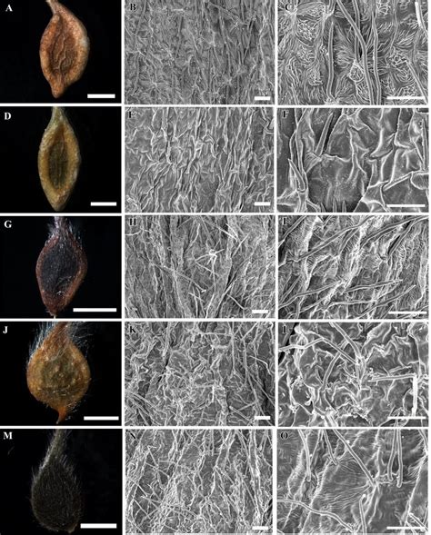 Stereomicroscopic And Scanning Electron Microscopic Micrographs Of