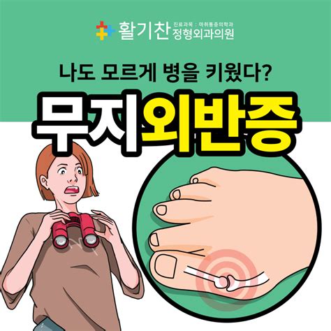 구파발정형외과 나도 모르게 병을 키울 수 있는 무지외반증 원인 네이버 블로그