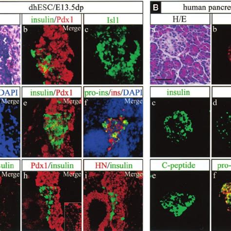 Hescs Differentiate Into Proinsulin ؉ And C Peptide ؉ Cells Which