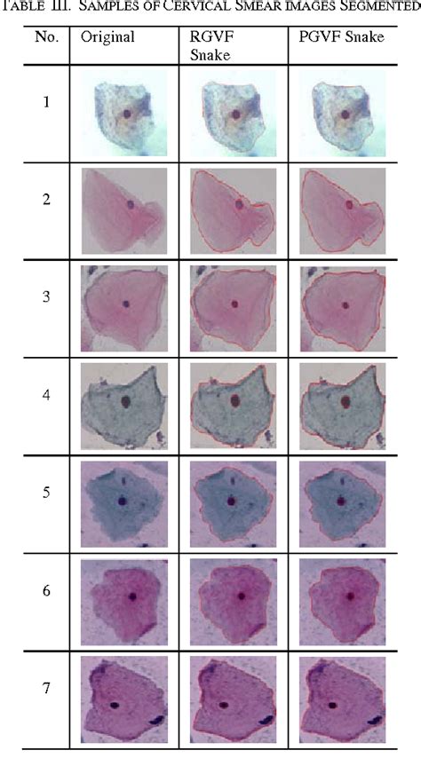 Table III From Cell Segmentation In Cervical Smear Images Using Polar