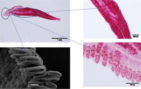 Heteromicrocotyla Sp Collected From The Gills Of Soldier Bream A