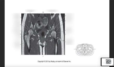 Sectional Anatomy 48 Diagram Quizlet