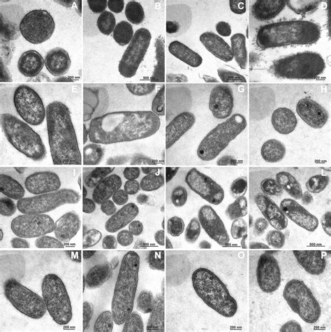 Electron Microscope Bacteria Images Micropedia