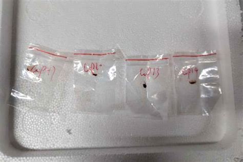 Chinese Couple Charged With Smuggling A Biological Pathogen Into The Us