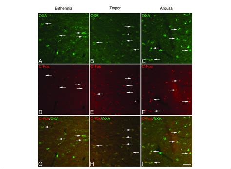 Pairs Ad Be Cf Of Fluorescence Photomicrographs Of Oxac Fos